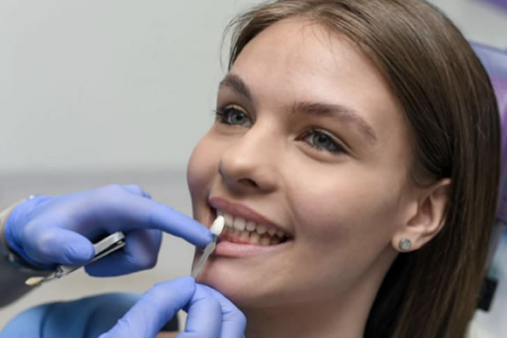 Solutions for Economically Priced Full Mouth Dental Implants in 2024 ...